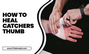 How To Heal Catchers Thumb - Expert Tips